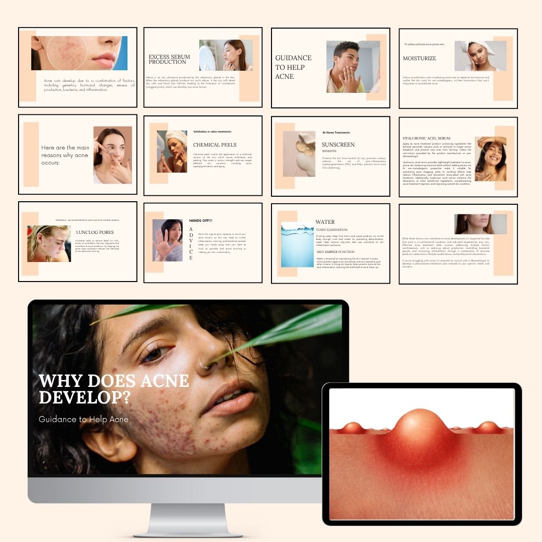 Acne Mini Manual – Beauty Comes True Academy