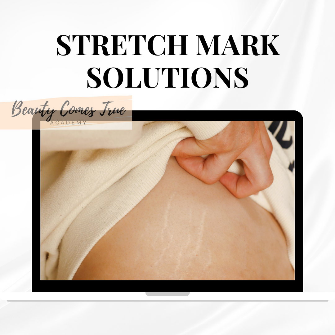Stretch mark solutions – Beauty Comes True Academy
